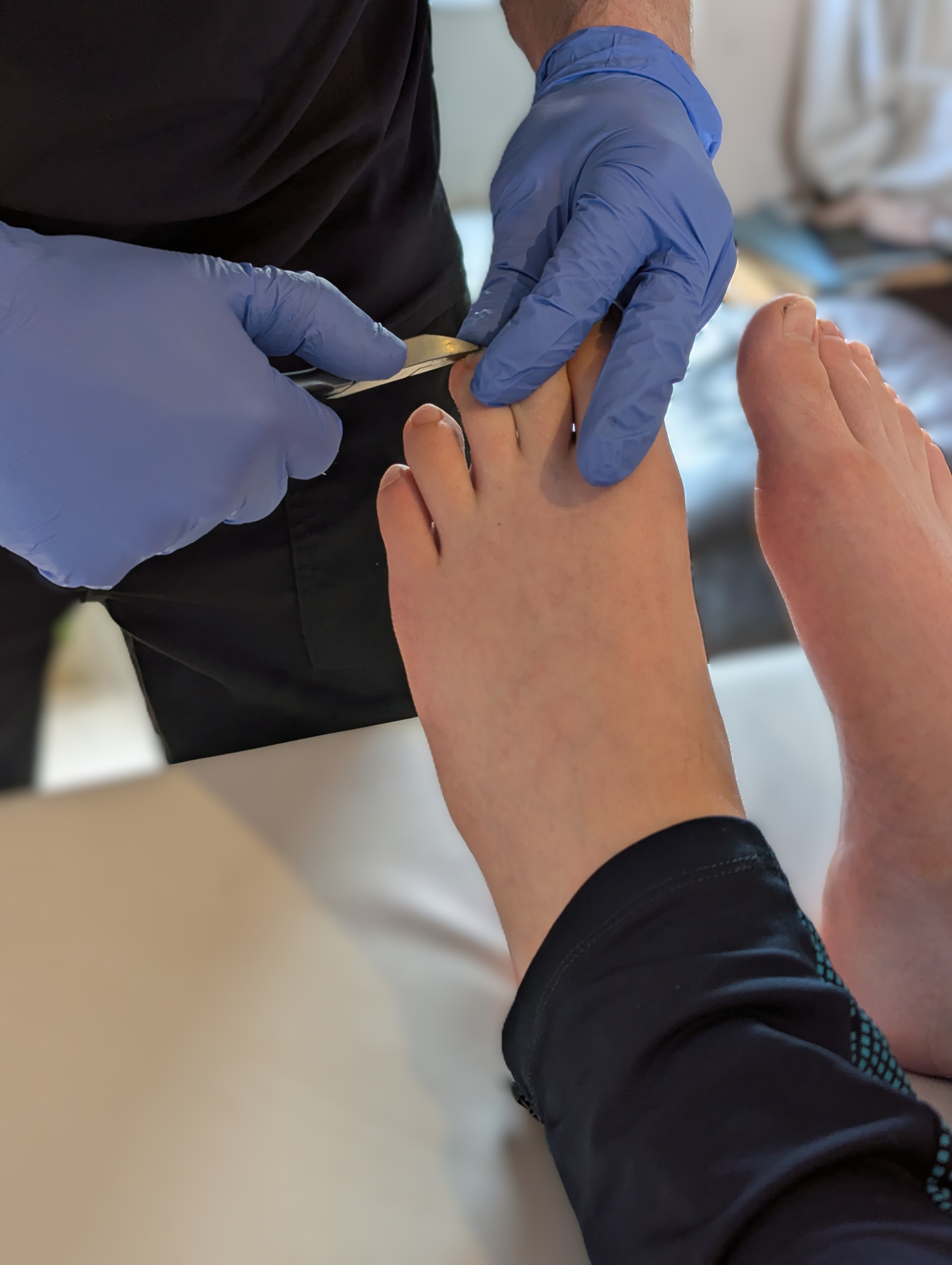 General Podiatry / Chiropody – S G Active Podiatry